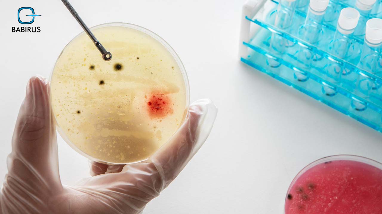 Food Allergy Test In Dubai: All You Need To Know