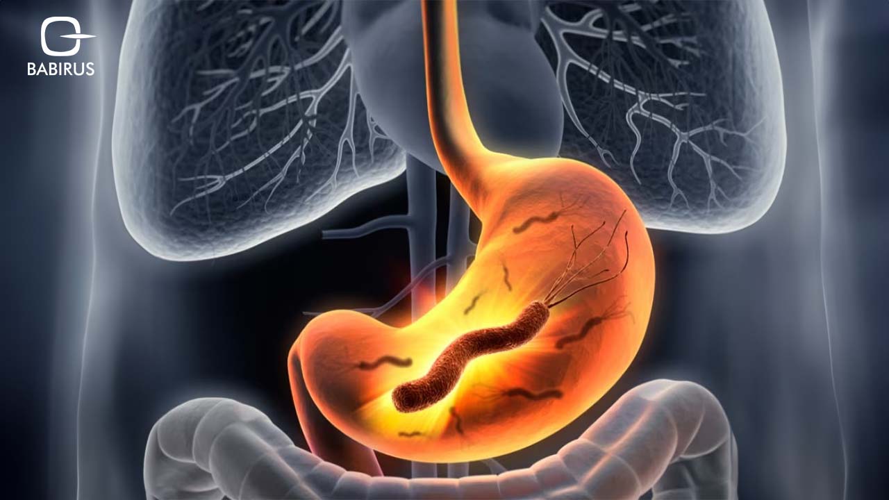 Helicobacter Pylori : Symptoms, Causes, & Treatment